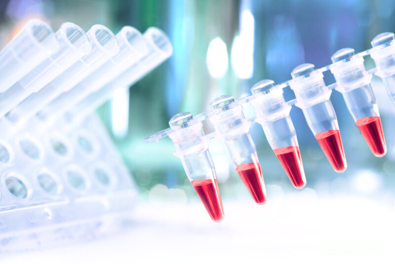 How to prevent PCR contamination – miniPCR Dx